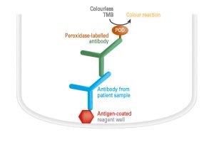 ELISA | Enzyme-linked immunosorbent assays | Euroimmun US