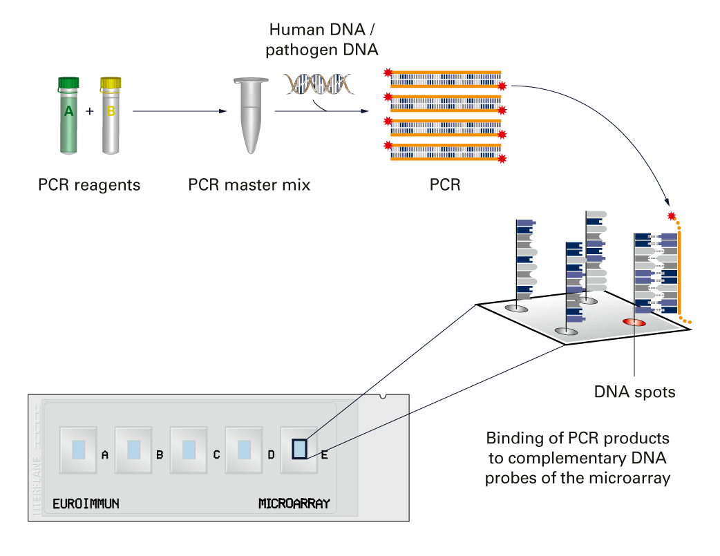 Microarray | EUROArray System | EUROIMMUN US