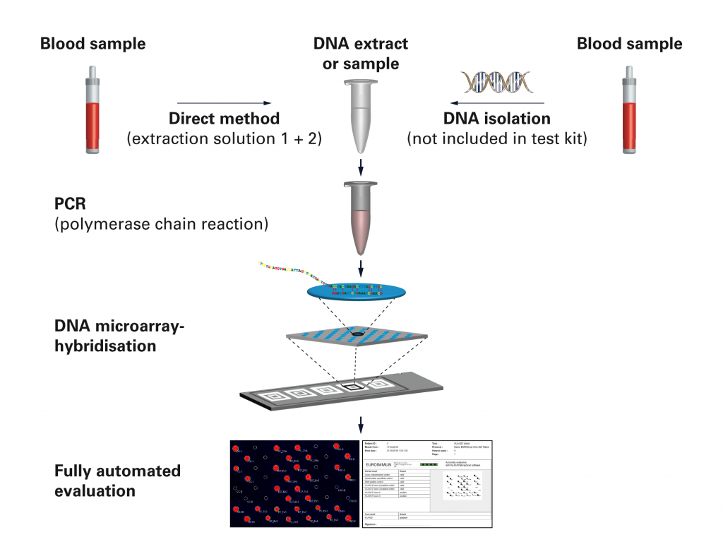 Microarray | EUROArray System | EUROIMMUN US