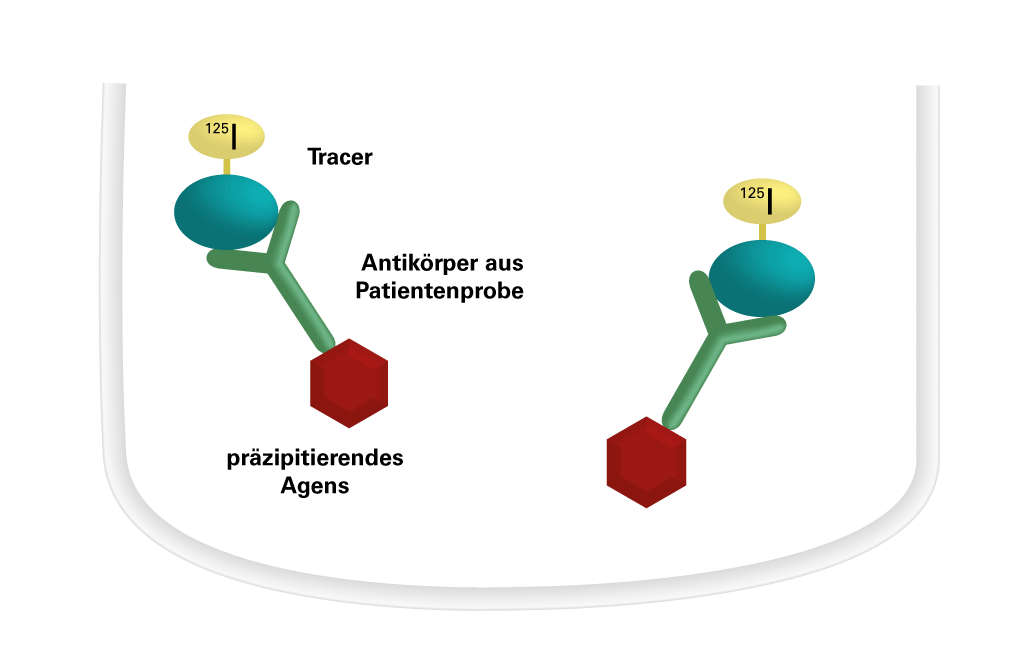 Radioimmunoassays | RIA | IRMA | Euroimmun US