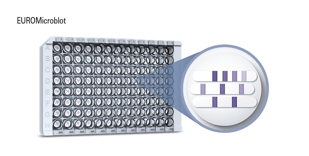 Immunoblot | EUROIMMUN US